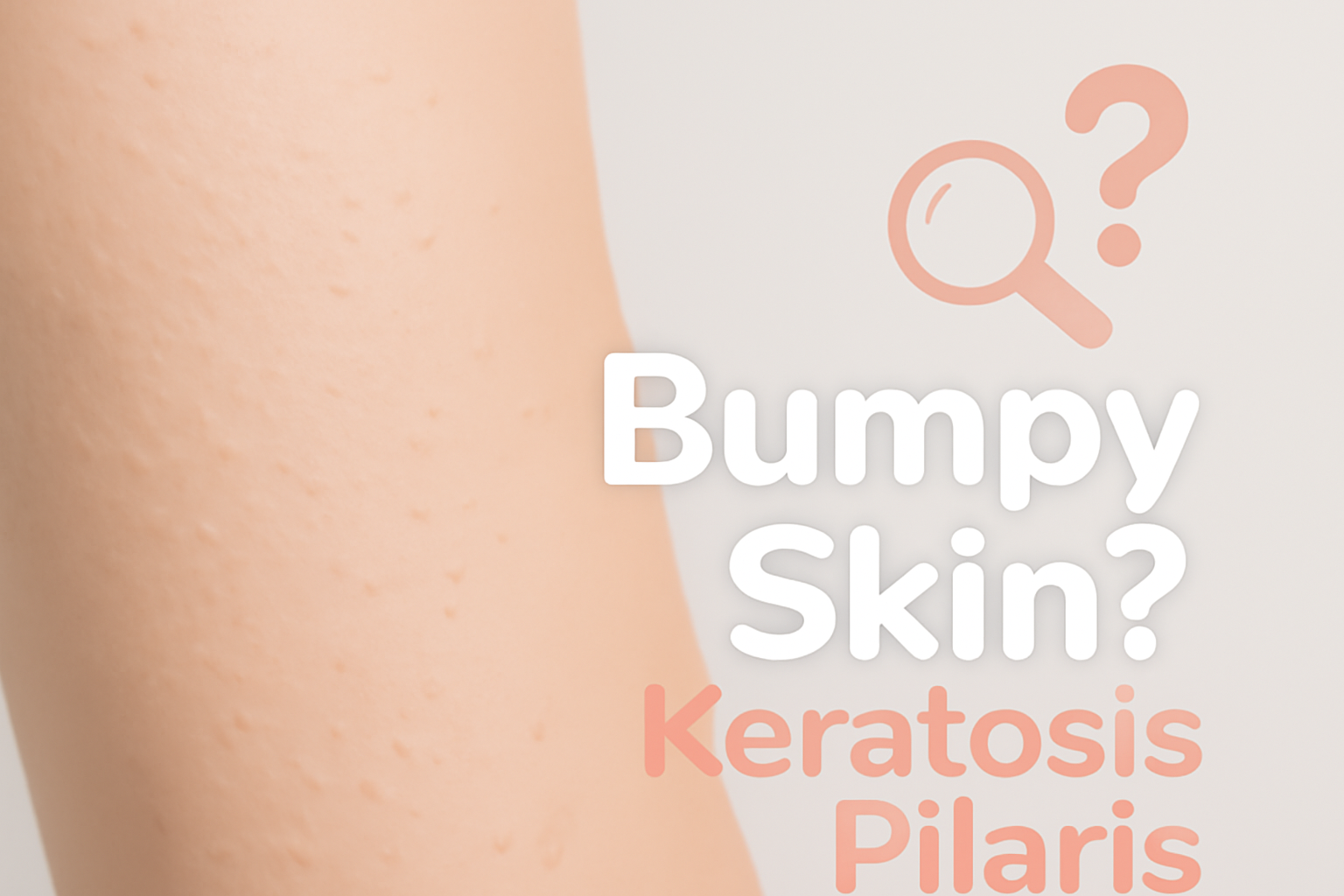 Worried About Bumpy Skin? Let’s Understand Keratosis Pilaris Properly ...